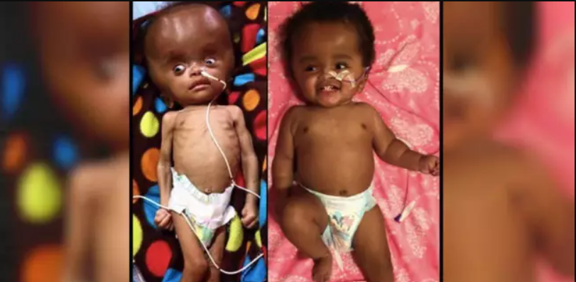 Doctors Said This Unwanted Baby Would Die, But What Happened Next Left ...